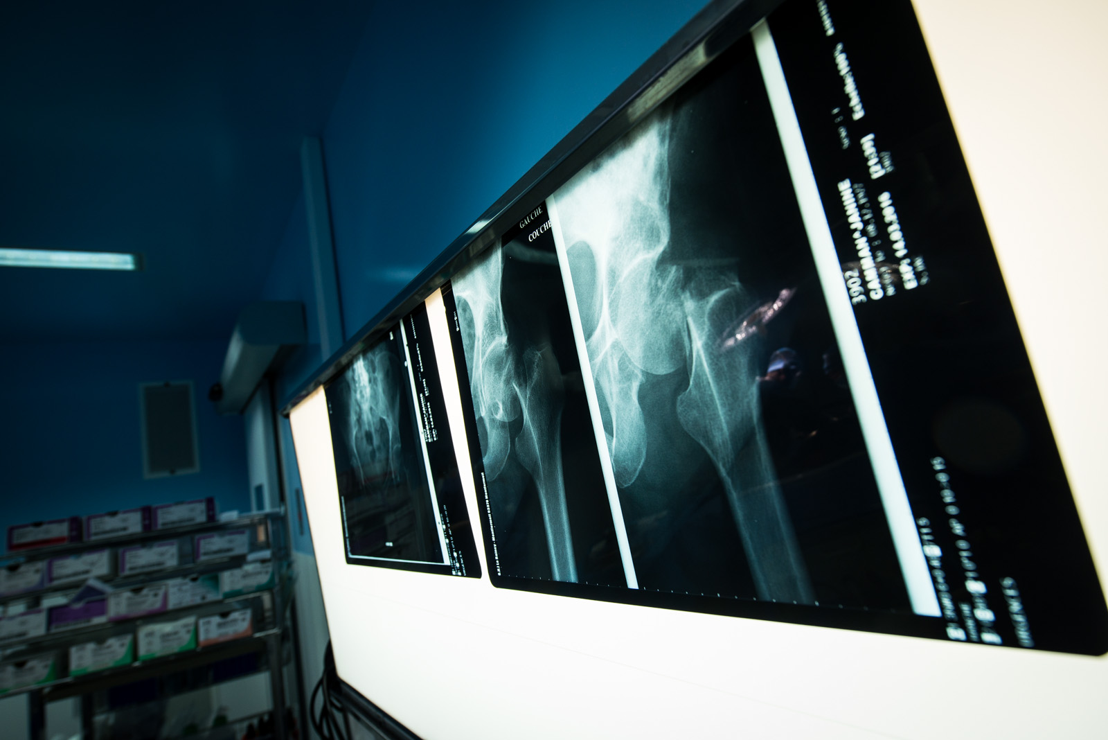 Chirurgie orthopédique - GHT GPNE